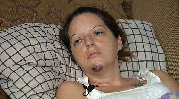 Mom claims deputy broke her jaw during a welfare check | khou.com