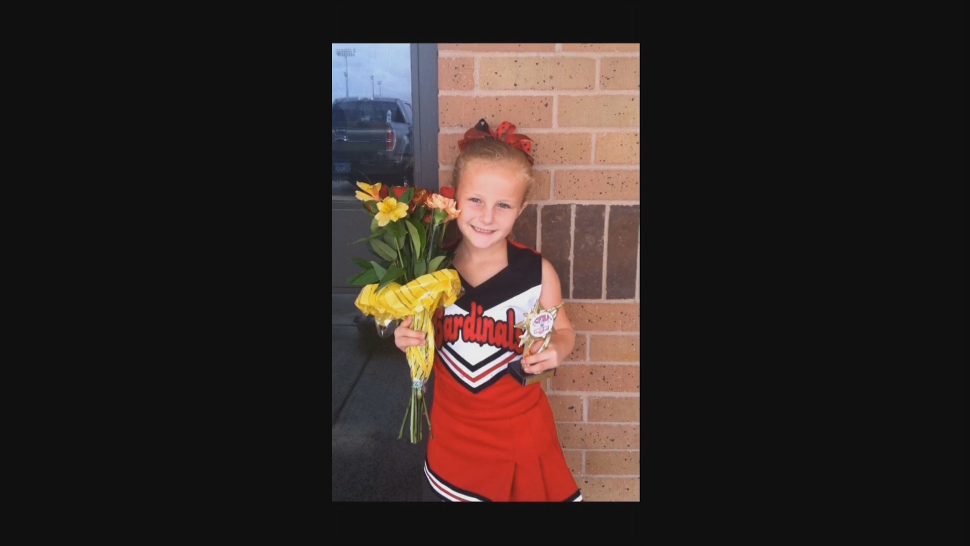 'Just like mine!': Little girl gets doll with prosthetic leg in viral ...