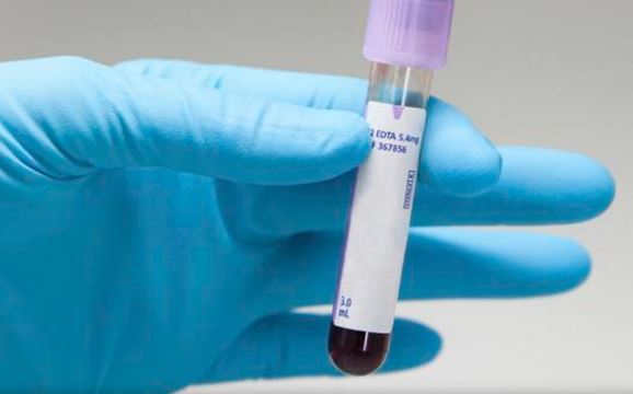 Blood cancer treatment called 'revolutionary' after all study patients ...